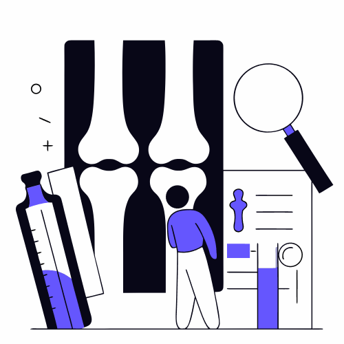Testing of femoral stems and ISO 7206-4 | IBV
